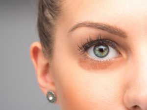 Entenda como se formam os 4 tipos de olheiras - Marcio Atalla